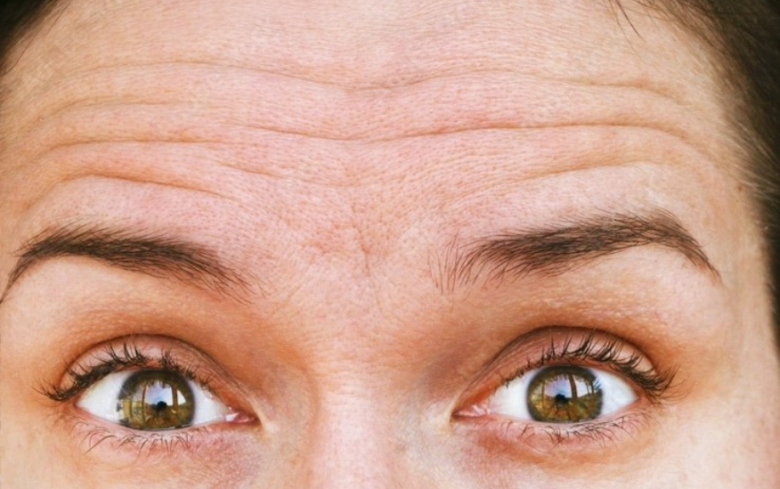 How To Reduce Wrinkles On Forehead?