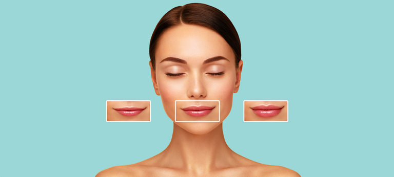 How Many Units of Botox for Lip Flip? Cost, Before and After